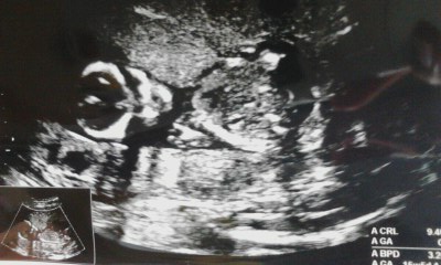 【14W5D】初めてのお腹からのエコー と 心配事 | Triple Hearts - 楽天ブログ