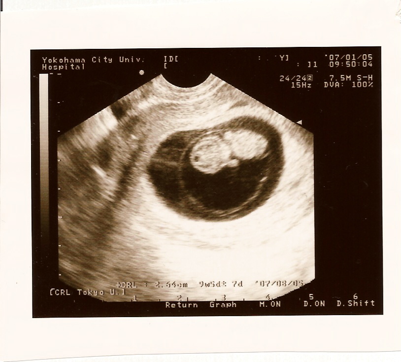 検診-9W5D- | マリ日記 - 楽天ブログ