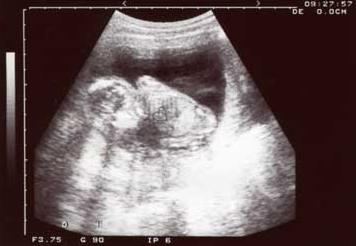 14w5d 妊婦健診（画像有） | いないいないばぁっ！に出演させたい - 楽天ブログ