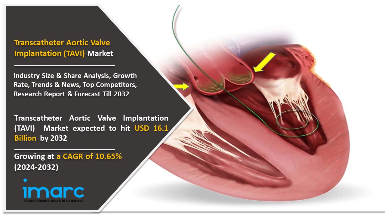 Global TAVI Market Analysis 2024: Size, Share, Growth, Forecast by 2032 | ravinderahlawatのブログ ...
