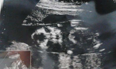 【14W5D】初めてのお腹からのエコー と 心配事 | Triple Hearts - 楽天ブログ