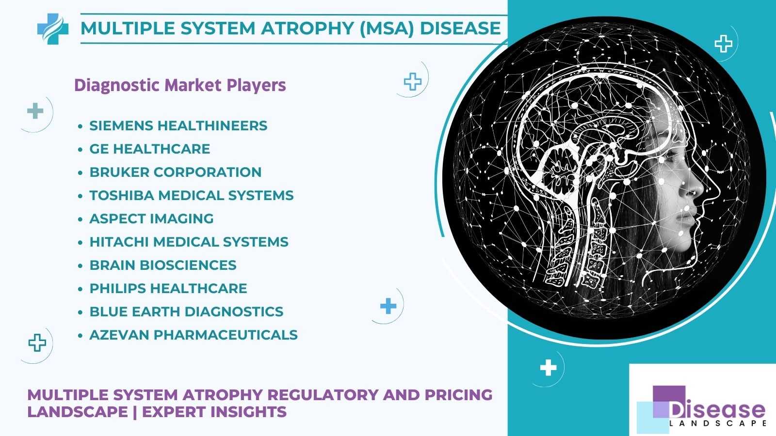 MSA Disease Unveiled: Segmentation, Diagnosis, and Treatment ...